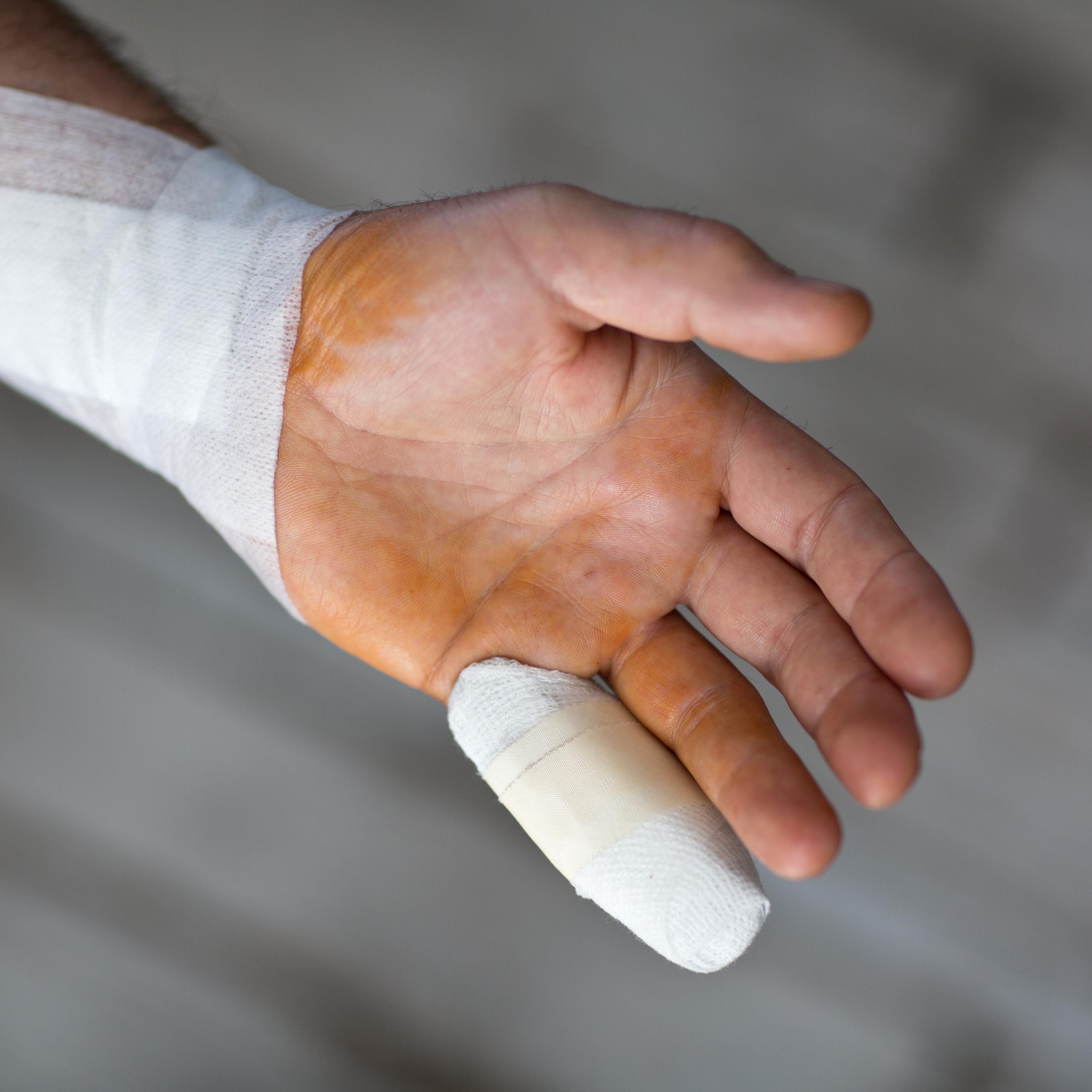 Har du styr på gårdens skjulte farer?